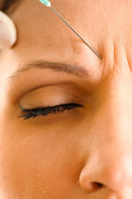 Botox Gone Wrong – What Every Injector Needs to Know to Prevent and ...
