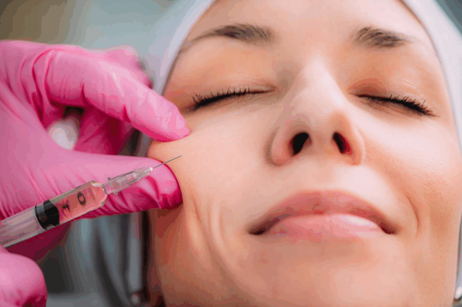 How to Recognize and Manage Cheek Filler Migration in Clinical Practice ...